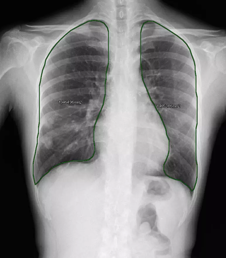 Dynamic Digital Radiography | KONICA MINOLTA